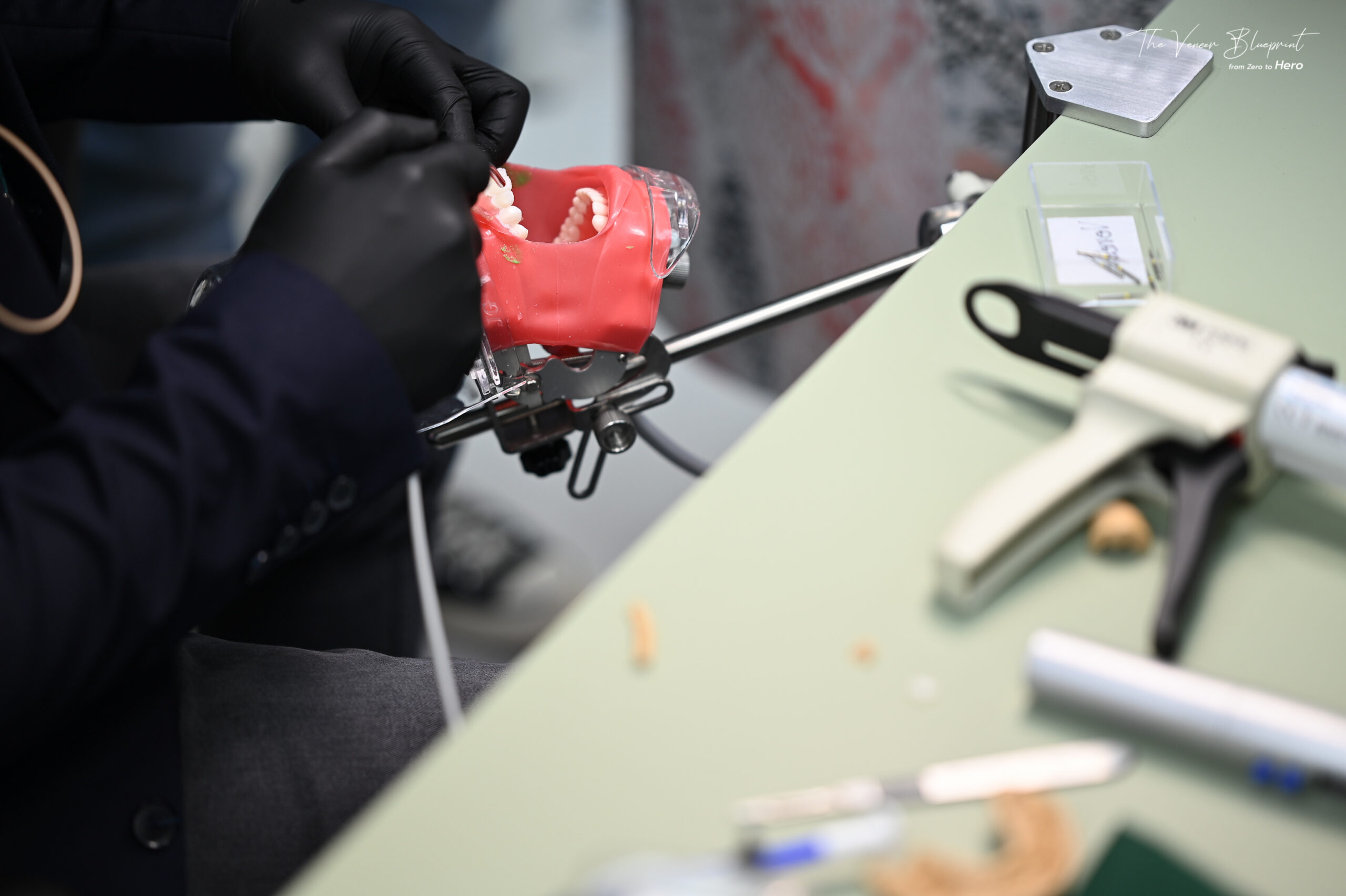 Veneer Blueprint Gen21 - MDC DENTAL CENTER