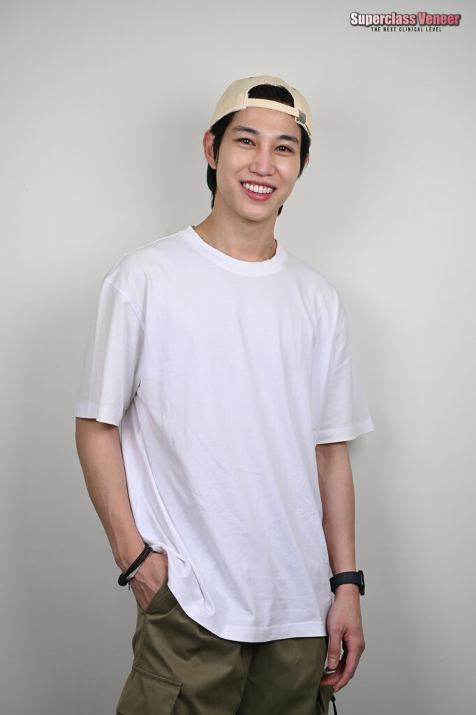 Superclass Veneer Gen4 - Mediclass